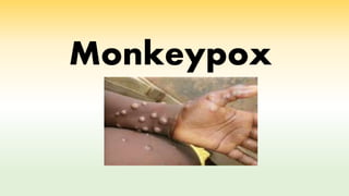 Monkeypox | PPTX