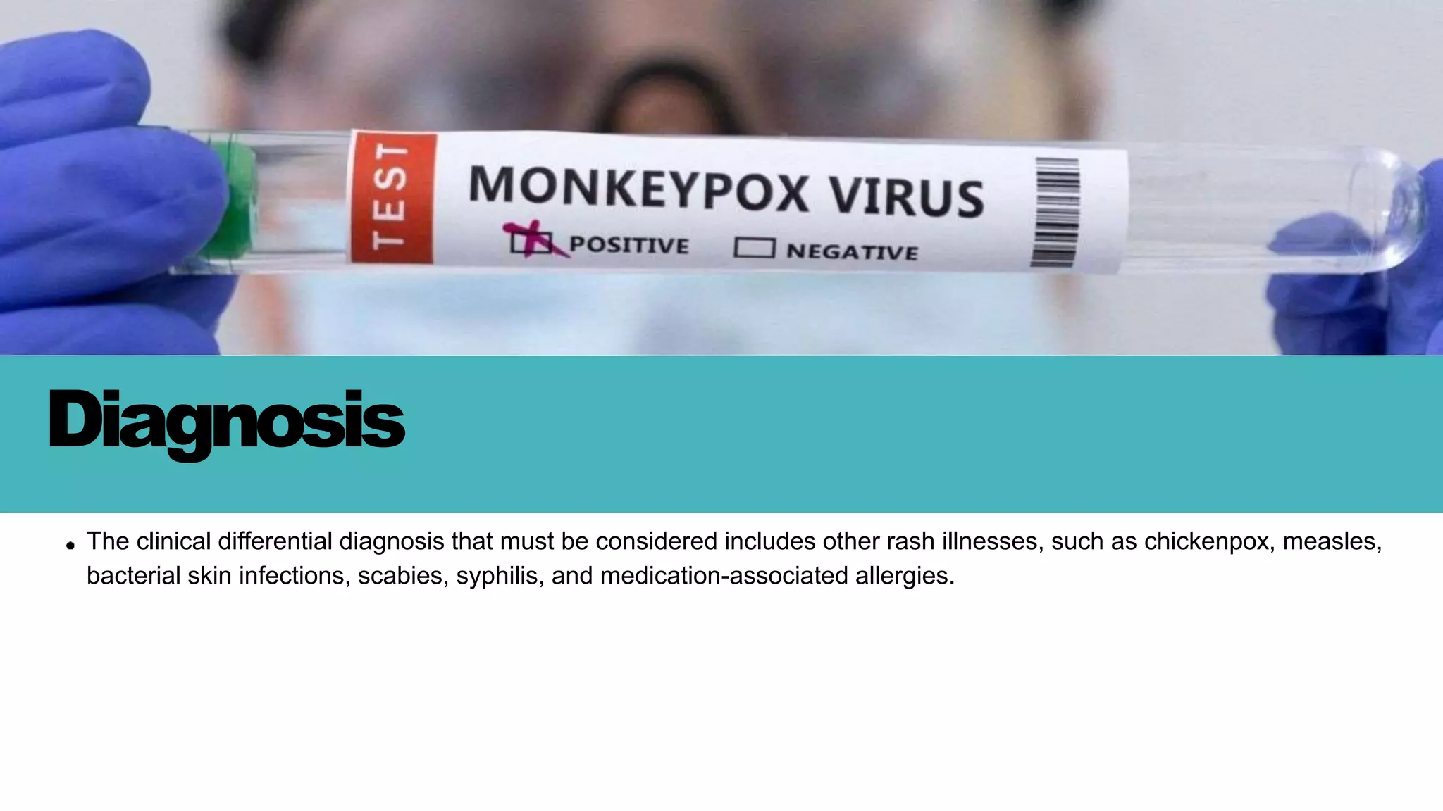 Monkey pox. (Anosh Nathaniel) | PPTX | Infectious Diseases | Diseases and Conditions