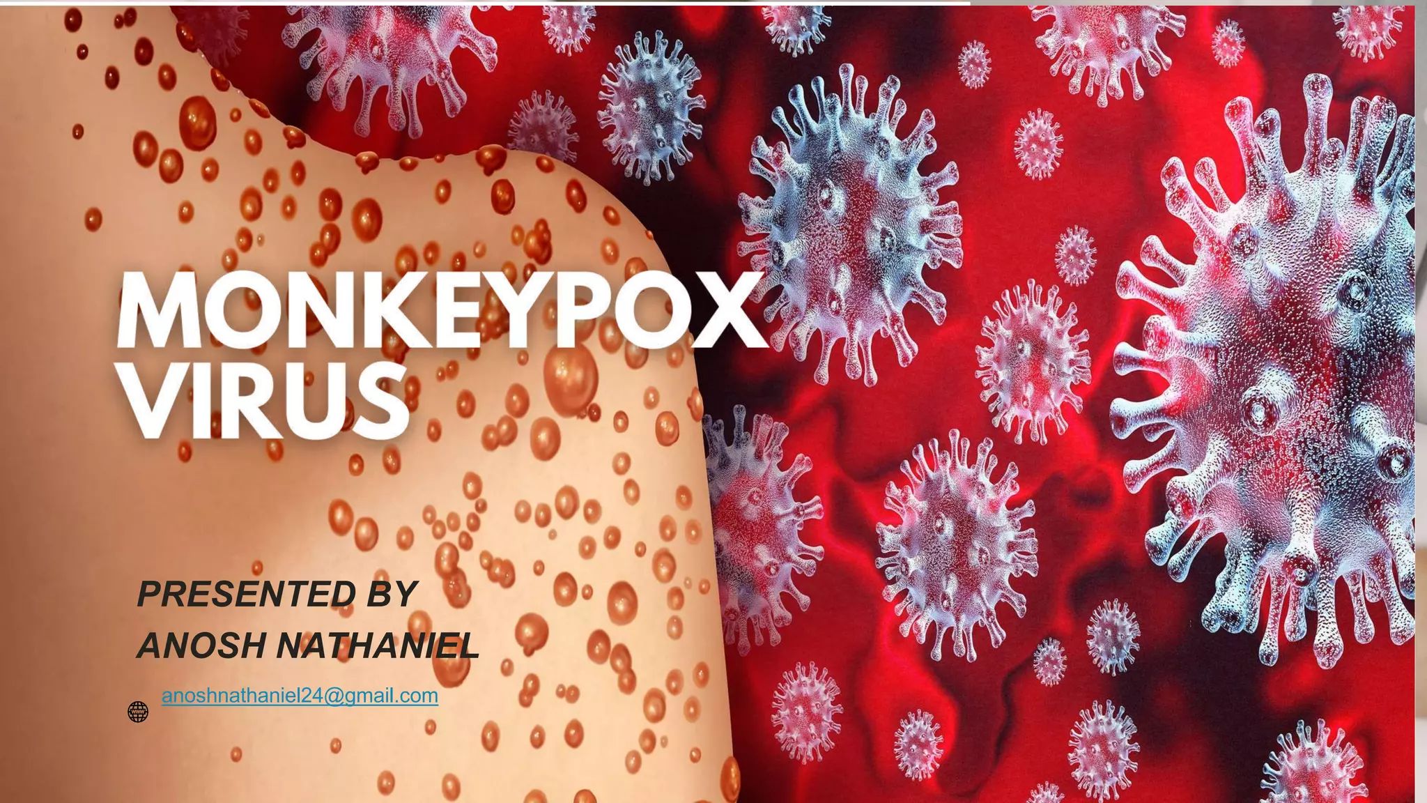 Monkey pox. (Anosh Nathaniel) | PPTX | Infectious Diseases | Diseases and Conditions