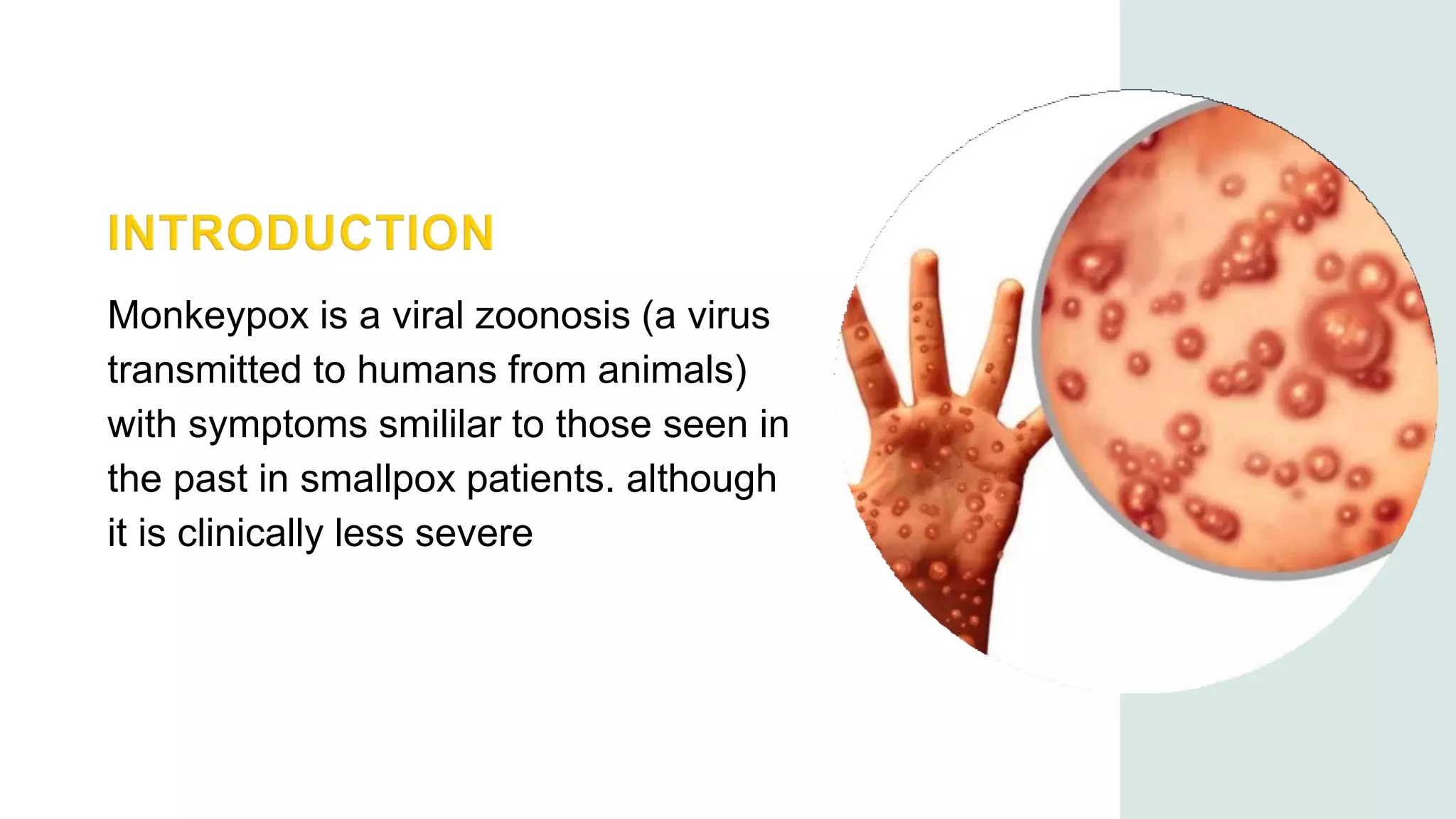 Monkey pox. (Anosh Nathaniel) | PPTX | Infectious Diseases | Diseases and Conditions