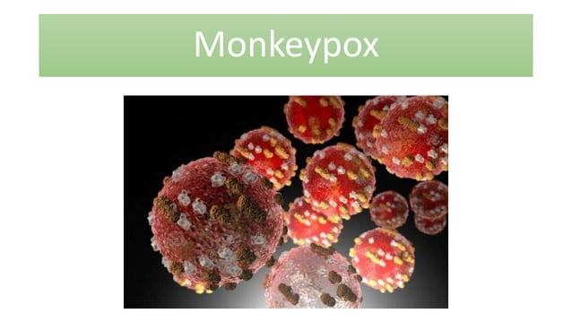 Monkey pox.pptx