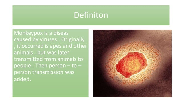 Monkey pox.pptx