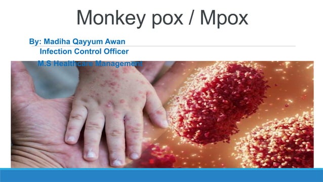 monkeypox.pptx Mpox outbreak/ spread and control | PPTX