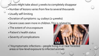 monkeypox- amended 2.pptx