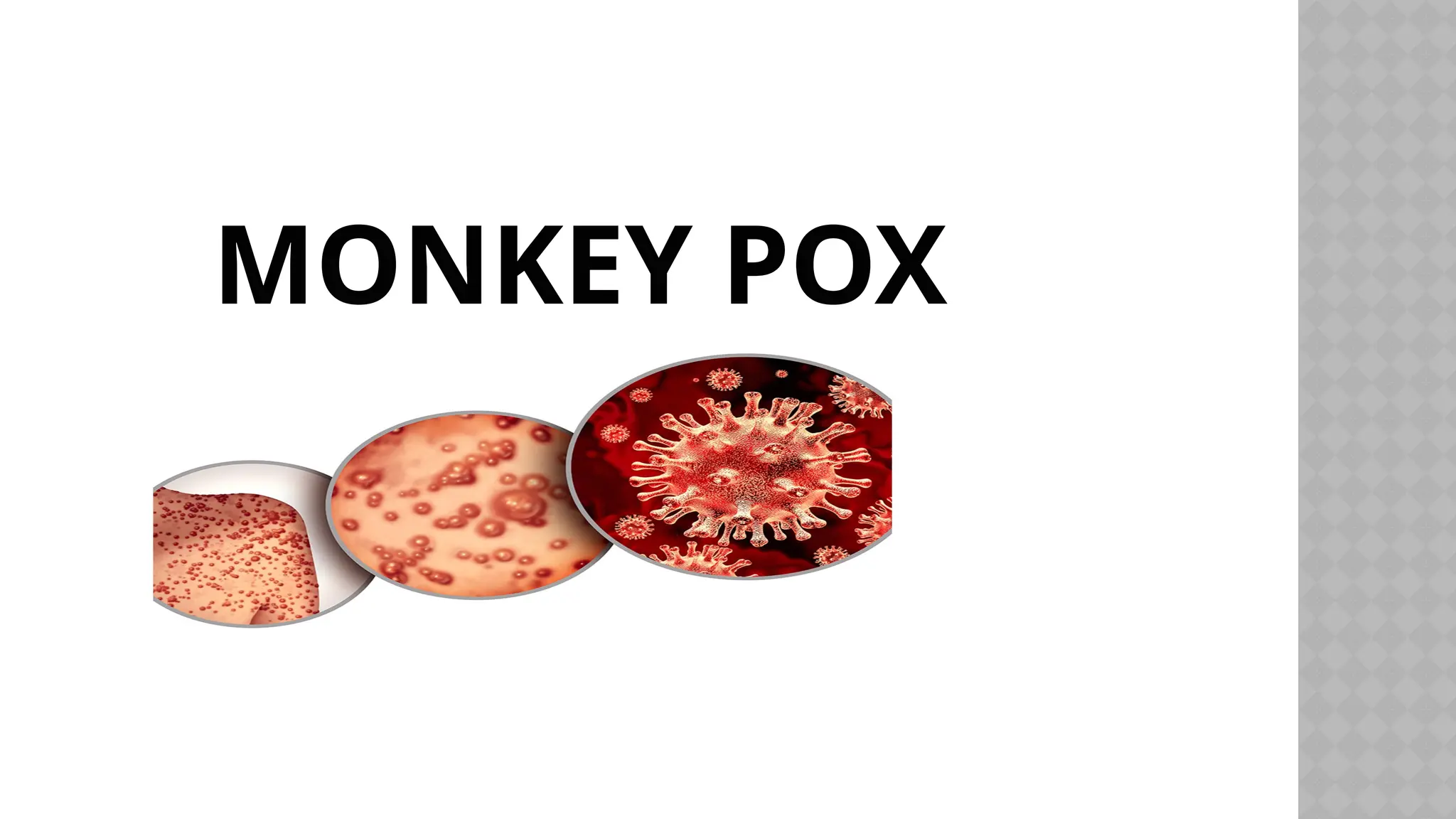 Monkey pox 24.medical surgical nursing ppt | PPTX