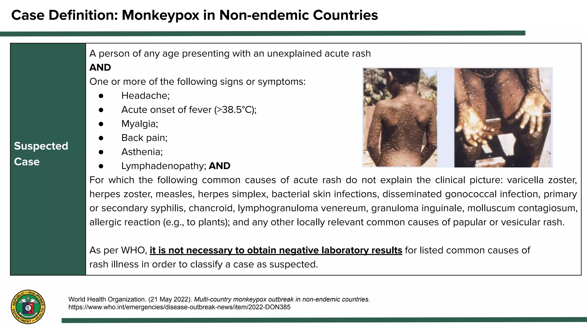 Monkeypox Facts 2022.pdf