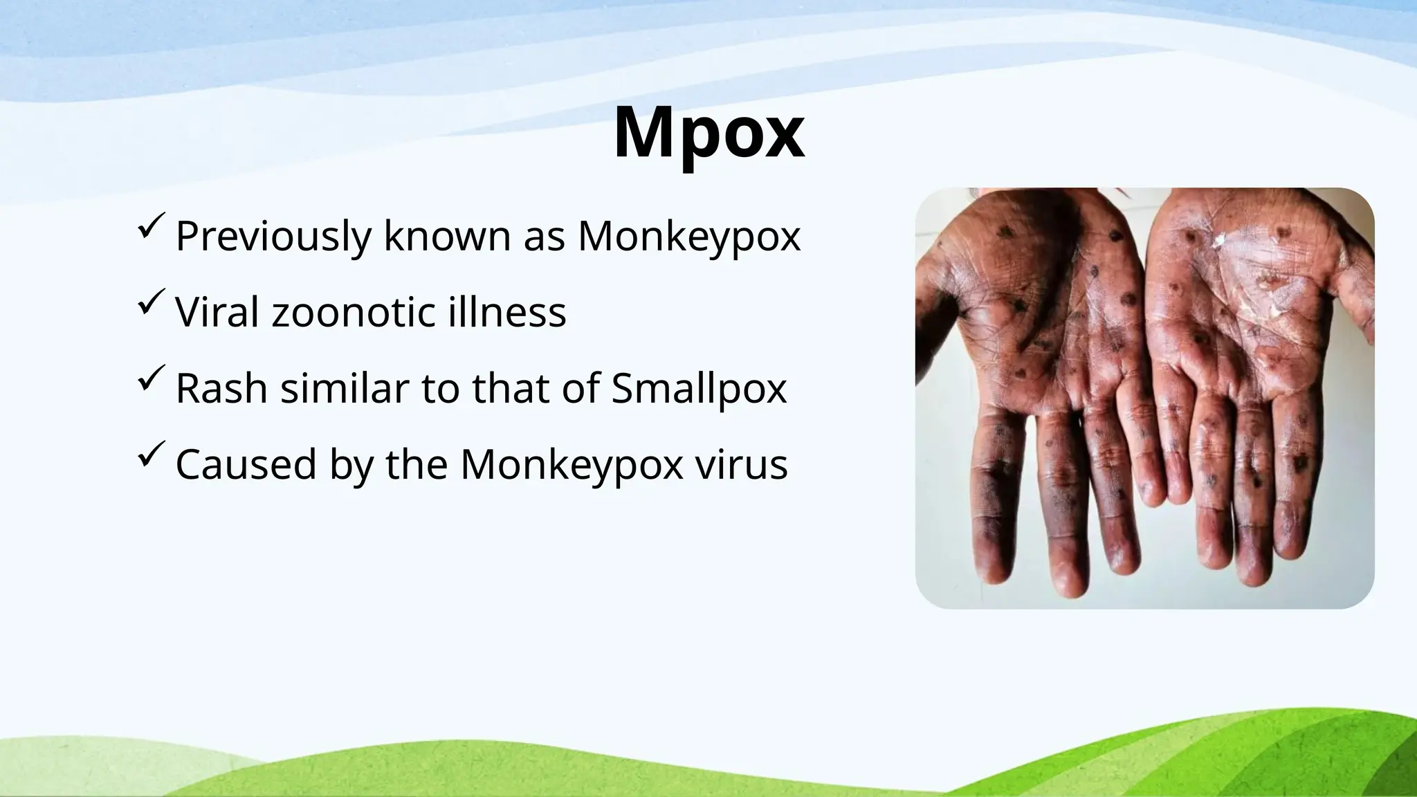 Monkeypox(Mpox) Outbreak - A Public Health Emergency Of International Concerns.pptx