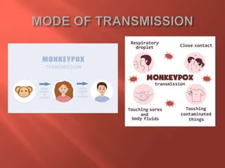 PRESENTATION DISEASE PROFILE OF MONKEYPOX | PPT