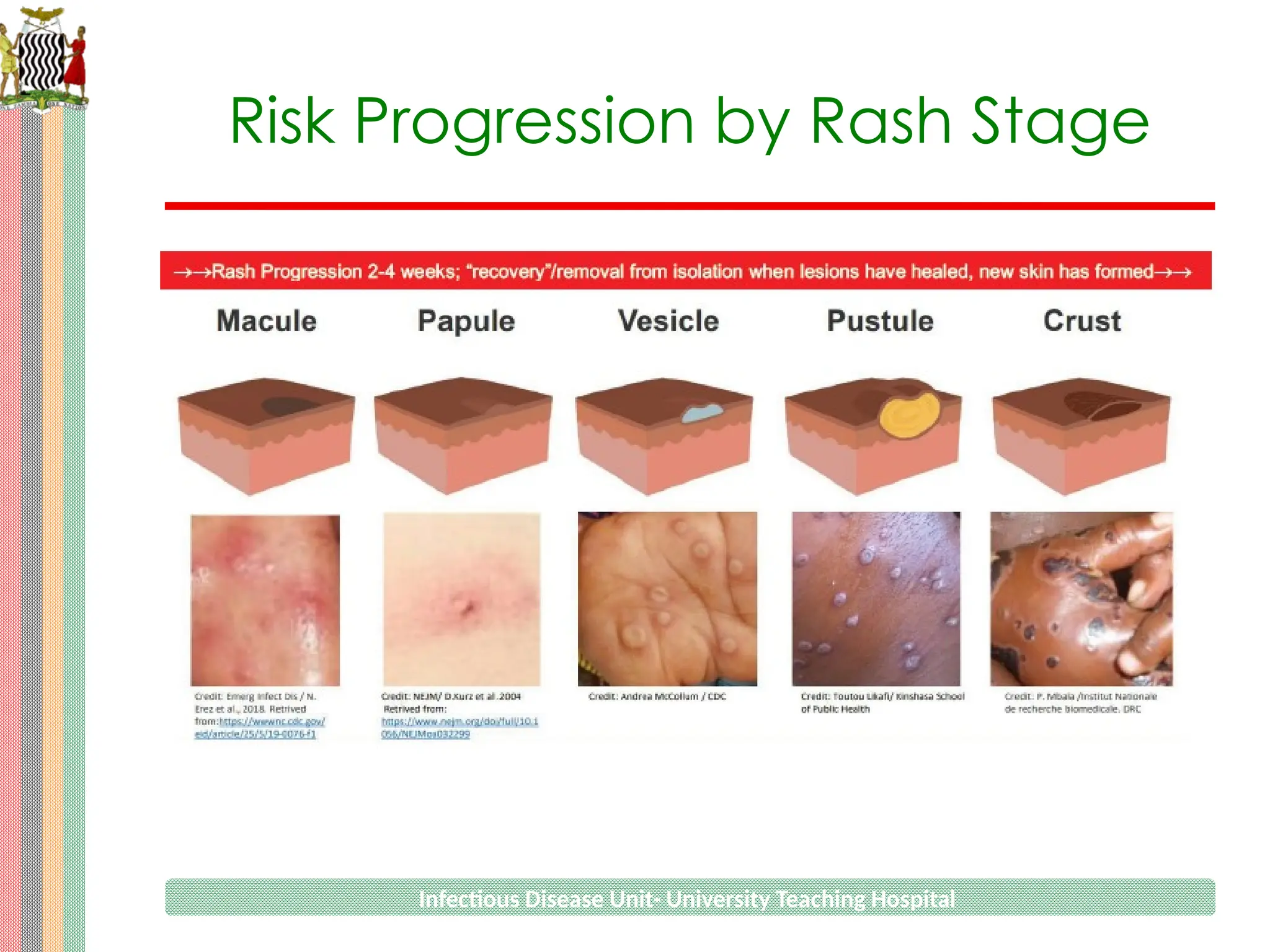 Monkey Pox slides; Get to learn the risk factors,presentation and ...