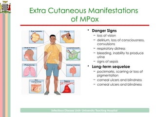Monkey Pox slides; Get to learn the risk factors,presentation and ...