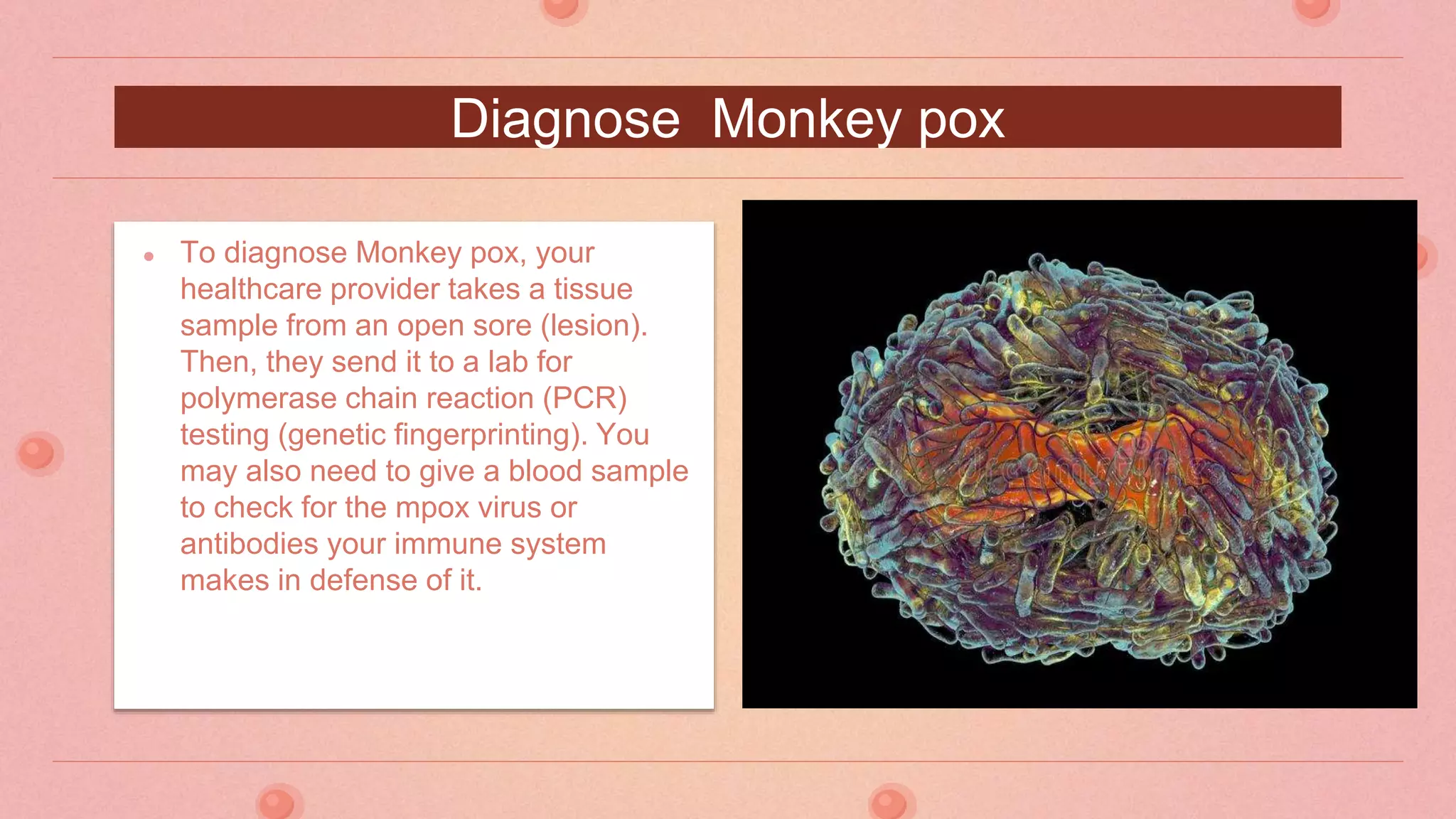 monky box virus.pptx