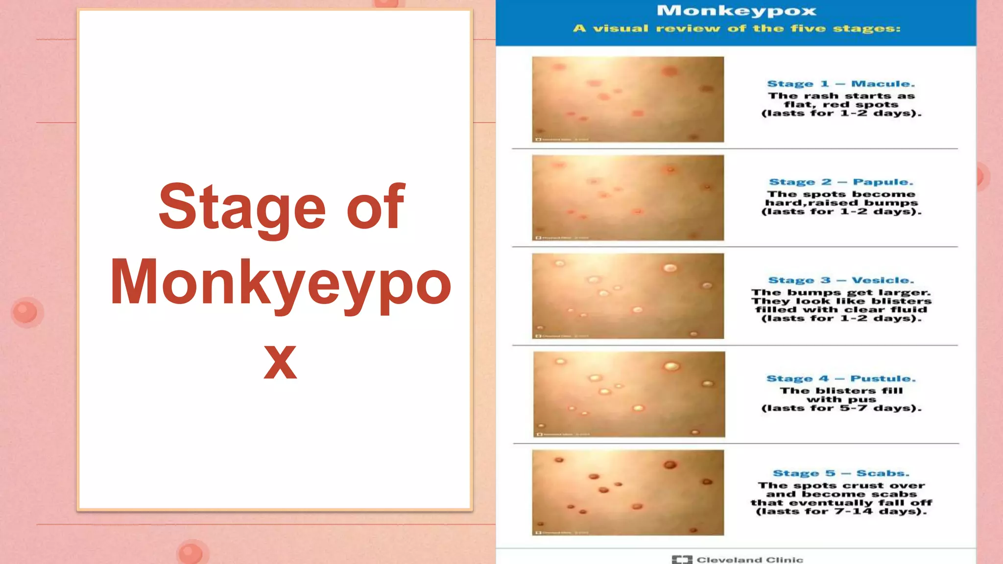 monky box virus.pptx