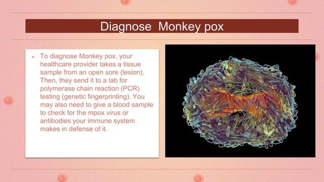 monky box virus.pptx