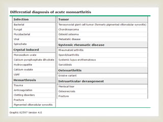 Monoarthritis | PPTX