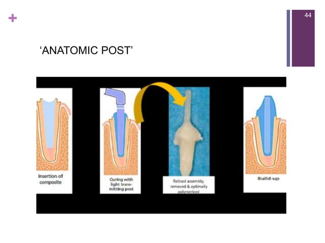Monoblock | PPTX | Dental Health | Diseases and Conditions