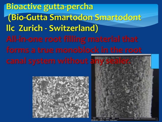 dental Monoblock obturation technique or concept in endodontics | PPTX ...
