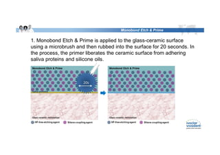 Monobond etch & prime | PDF