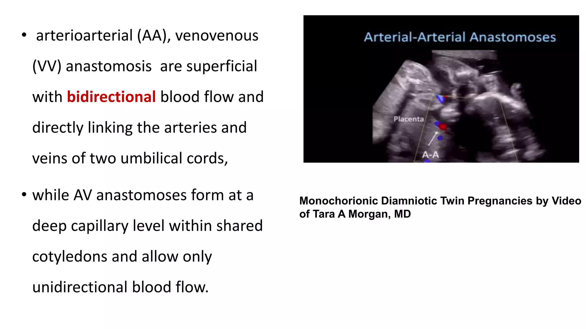 Anatomy of Monochorionic diamniotic twin | PPTX