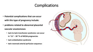 Anatomy of Monochorionic diamniotic twin | PPTX