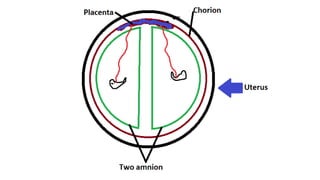 Anatomy of Monochorionic diamniotic twin | PPTX