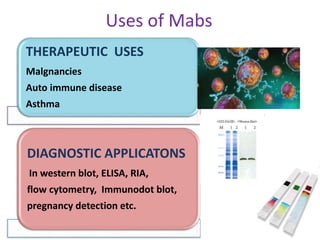 Monoclonal antibodies dr.elza