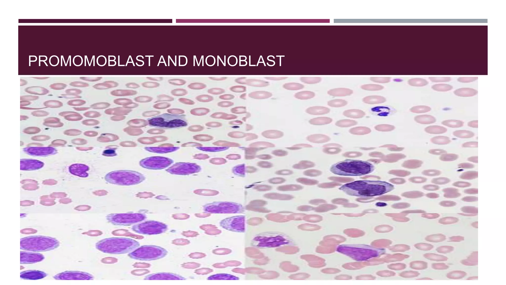 Monocytosis | PPTX