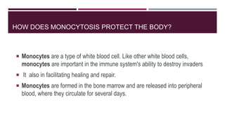 Monocytosis | PPTX