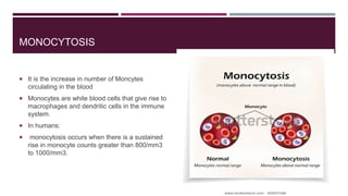 Monocytosis | PPTX