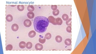 What is Monocytosis, By Doctor Rifat | PPTX