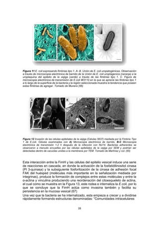 Infección urinaria asociada a catéter vesical | PDF