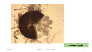 monograph of erysiphe cichoracearum by Sachin r kondaguri.pptx