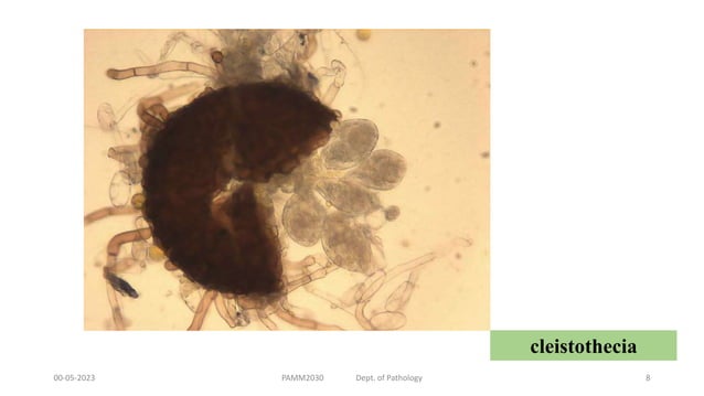 monograph of erysiphe cichoracearum by Sachin r kondaguri.pptx