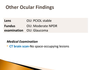 Case study: Sixth Nerve Palsy (Optometric Management) | PPT