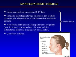 Mononucleosis | PPT