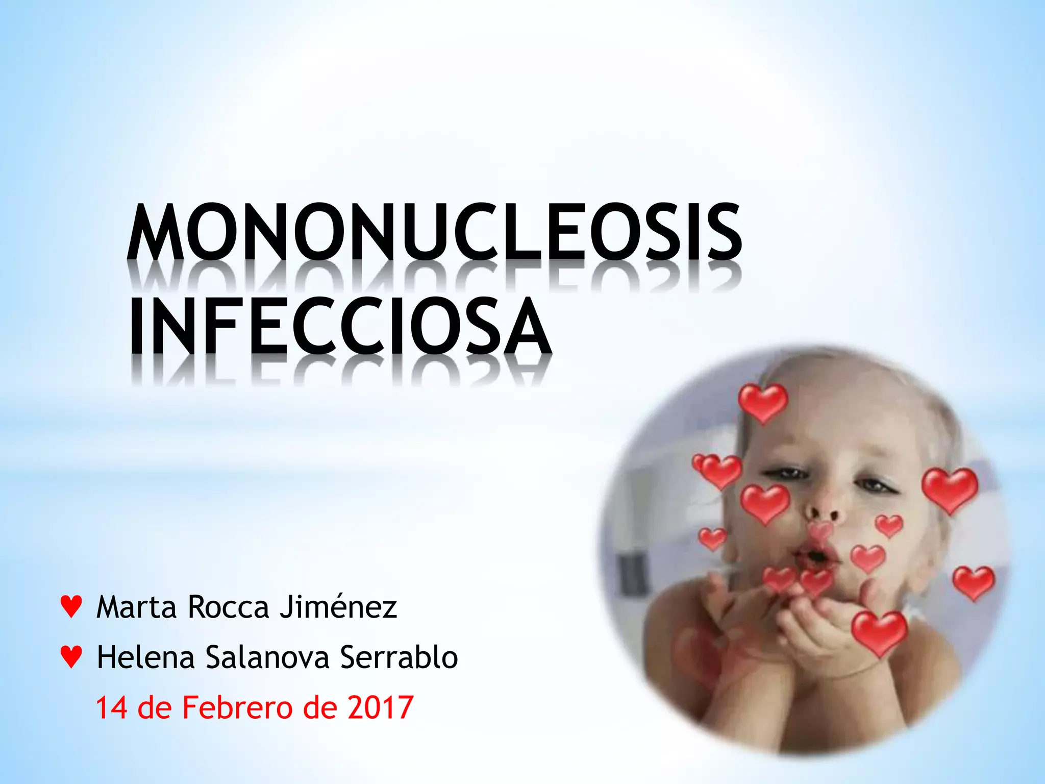 (2017-02-14) Mononucleosis infecciosa (PPT) | PPTX