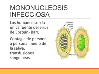Mononucleosis infecciosa | PPTX