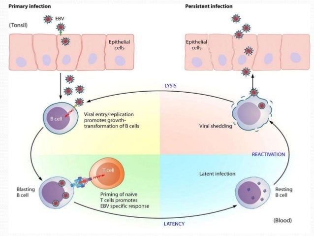 Mononucleosis infecciosa