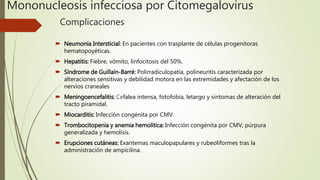 Mononucleosis infecciosa CMV | PPTX
