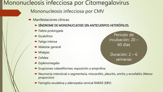 Mononucleosis infecciosa CMV | PPTX