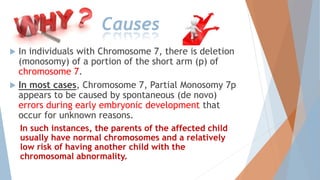Monosomy 7