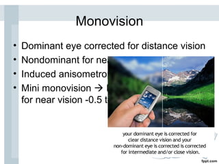Monovision | PPT