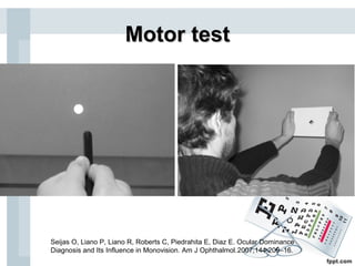 Monovision | PPT