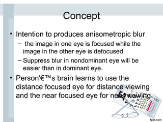 Monovision Drawbacks