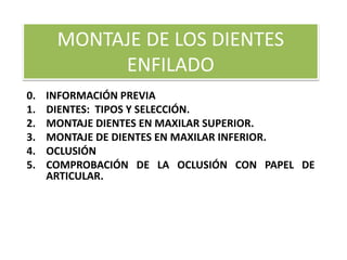 Montaje de los dientes enfilado | PDF