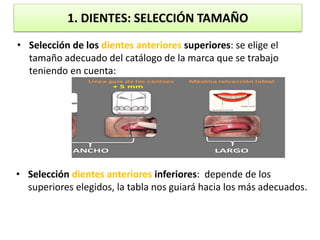 Montaje de los dientes enfilado | PDF | Oral care | Personal Care