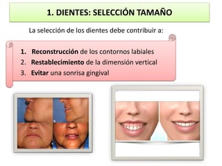 Montaje de los dientes enfilado | PDF