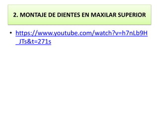 Montaje de los dientes enfilado | PDF | Oral care | Personal Care