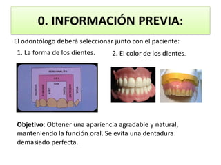 Montaje de los dientes enfilado | PDF