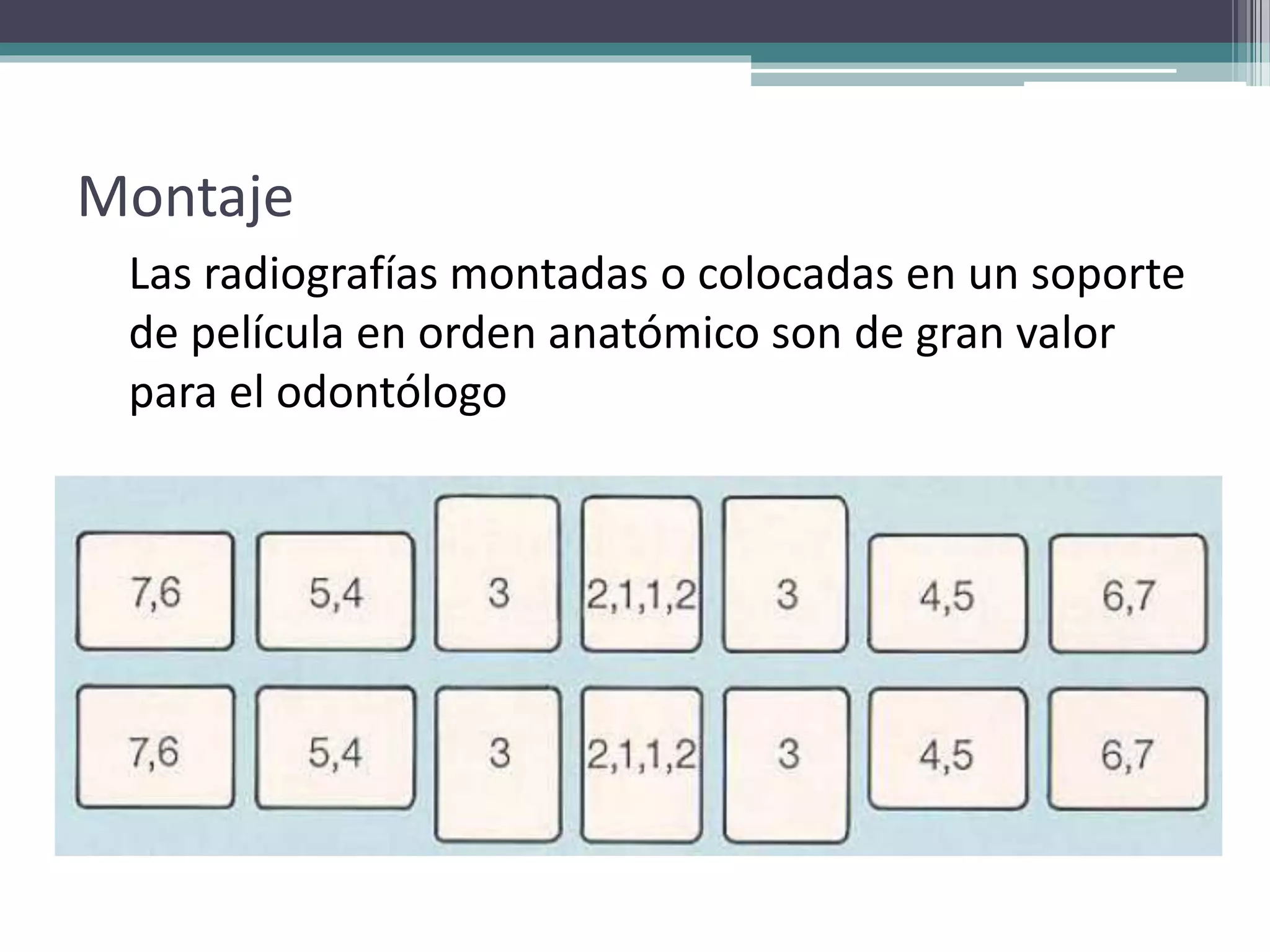 Montaje de radiografías y anatomía radiográfica | PPTX