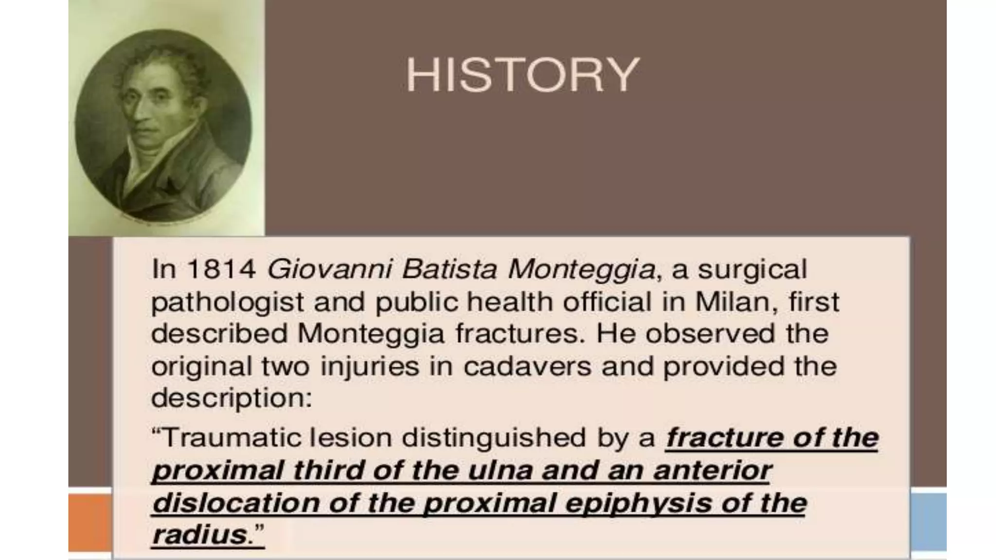 Monteggia fracture dislocation | PPTX